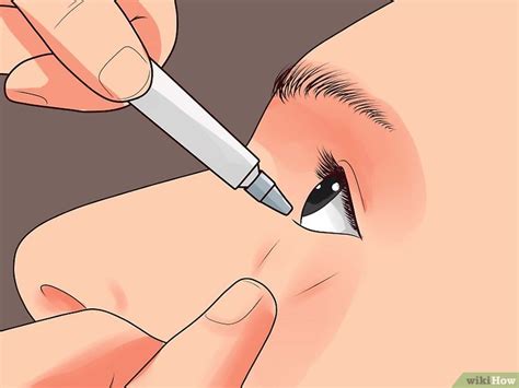 Come Usare Una Pomata Oftalmica Con Eritromicina