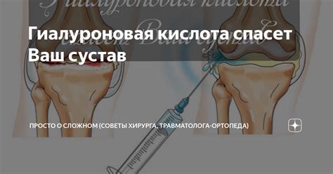 Гиалуроновая кислота спасет Ваш сустав Просто о сложном советы хирурга травматолога ортопеда