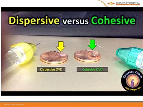 Ophthalmic Viscosurgical Devices Pptx Eye And Vision Conditions Diseases And Conditions