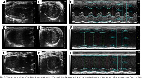 Figure 5 From New Approaches In Small Animal Echocardiography Imaging
