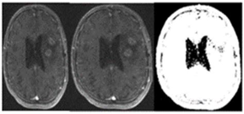Figure 1 From Implementing U Net Model For Automatic Segmentation Of