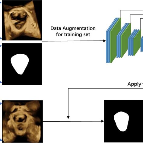 Architecture Of Unet Resnet34 Hr Net And Segnet Download Scientific