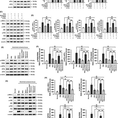 Melatonin Protects Against Oxidative Er Stress Through The Upregulation