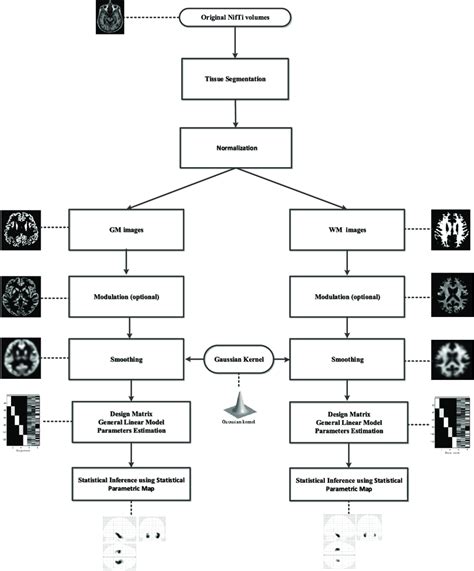The Processing Framework In A Standard Voxel Based Morphometry Download Scientific Diagram