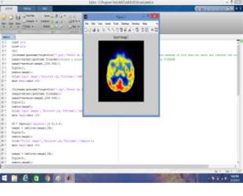 Figure 2 2 From MULTIMODAL IMAGE FUSION BY USING NON SUBSAMPLED
