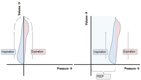 Interpreting The Shape Of The Pressure Volume Loop Deranged Physiology