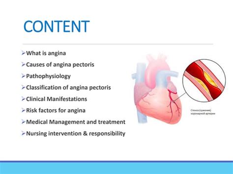 Angina Pectorisseminarpptx Pptx Angina Pectorisseminarpptx Pptx