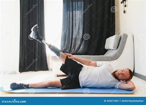 Man Amputee With Prosthetic Leg Disability On Transfemoral Leg Prosthesis Artificial Device