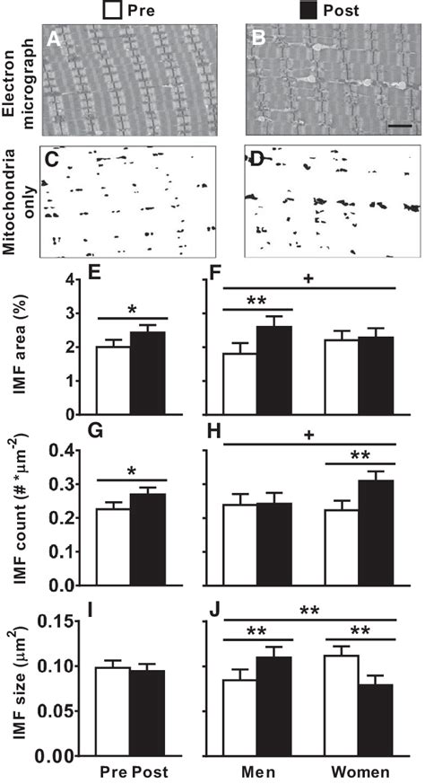 A D Representative Images Showing Electron Micrographs A And B And Download Scientific