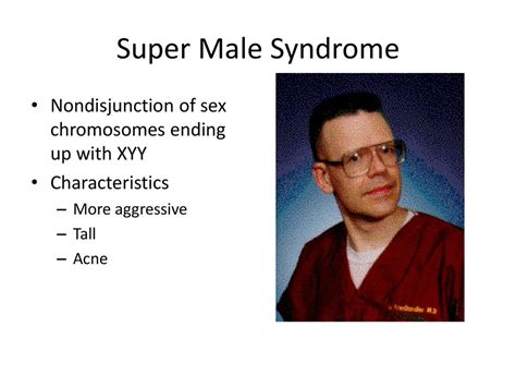 Xyy Super Male Syndrome