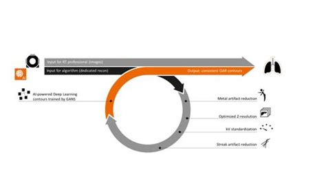 Autocontouring In Radiation Therapy Siemens Healthineers Siemens Healthineers