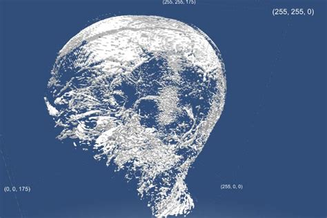 Isosurface Visualisation Of Medical Data In A Virtual Reality