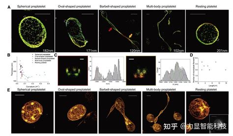 【文献解读】超分辨率成像揭示血小板成熟中期细胞骨架依赖性细胞器重排 知乎