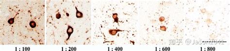 免疫组织化学的抗体稀释度实验 知乎