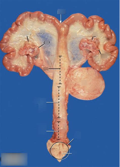 Diagram Of Female Repro Anatomy Quizlet