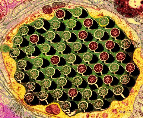 Bebite By 1774744 On Deviantart