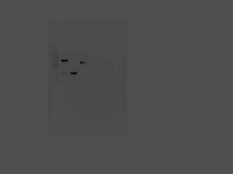 How Do I Determine Primer Annealing Temperature ResearchGate