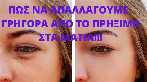 5 ΑΙΤΙΕΣ ΚΑΙ ΛΥΣΕΙΣ ΓΙΑ ΠΡΗΞΙΜΟ ΣΤΟ ΠΡΟΣΩΠΟ Youtube