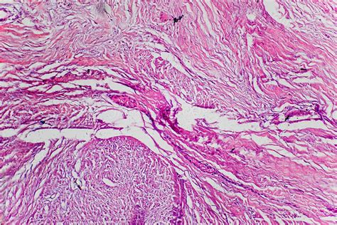 Human Connective Tissue