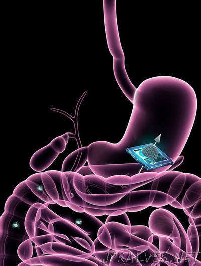 Medicine Of The Future New Microchip Technology Could Be Used To Track Smart Pills