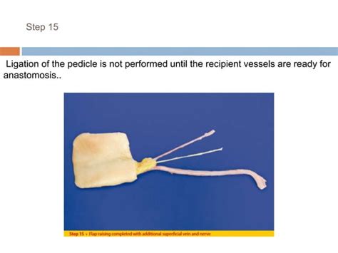 Radial Forearm Flap Hand Surgery Pptx Radial Forearm Flap Hand Surgery Pptx