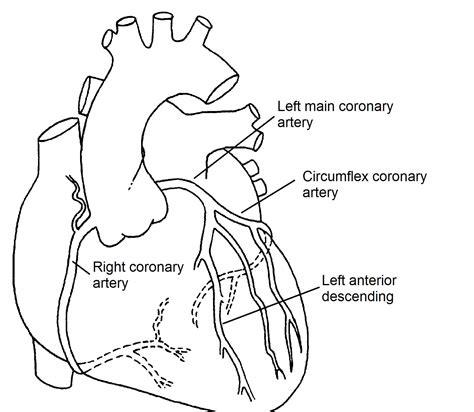 Coronary Anatomy Angiogram Anatomy Drawing Diagram My Xxx Hot Girl