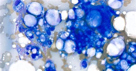 The Benefits Of Digital Cytology And Histology Working Together Nationwide Laboratories
