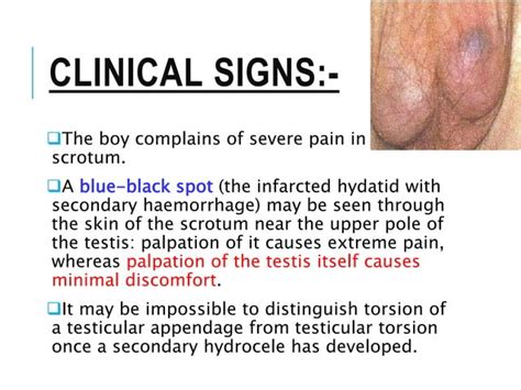 The Acute Scrotumpptx