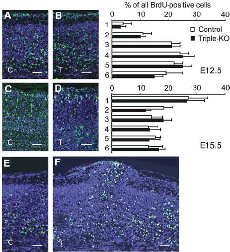 Neuronal Migration In The Cerebral Cortex Is Unaltered In Triple