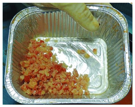 Bone Chips After Repeated Washing To Eliminate Blood And Bone Marrow