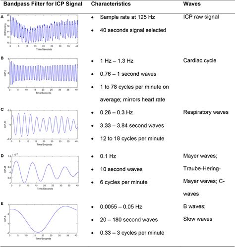 Intracranial Pressure Waveform