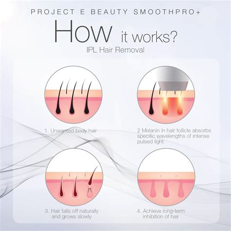 Electrolysis Vs Laser Hair Removal The Complete Guide Artofit