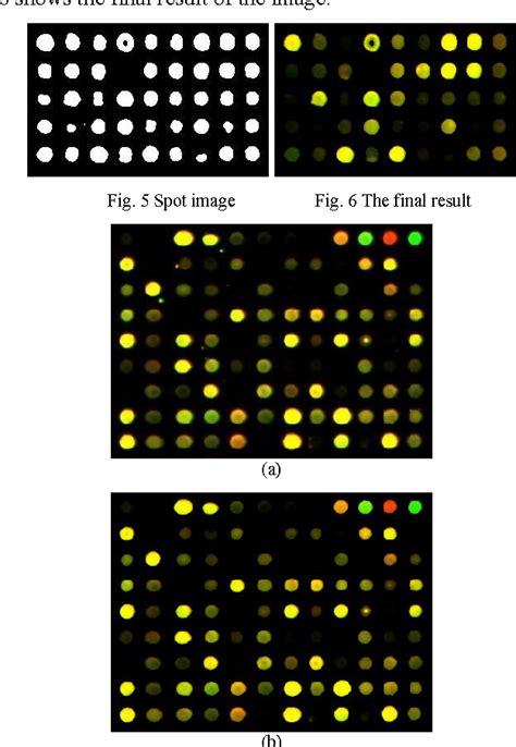 figure 5 from segmentation of cdna microarray spots using k means clustering algorithm and