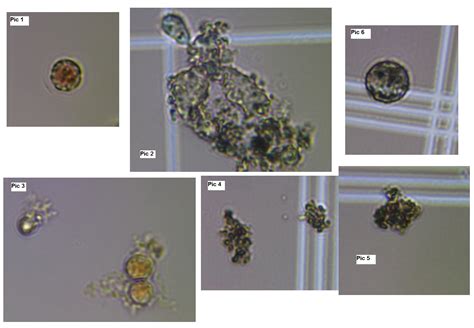 How To Survive Dying Microalgae Cells Why Are They Dying Researchgate
