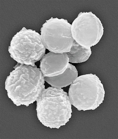 Micrococcus Luteus 3 Photograph By Science Photo Library Fine Art