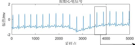 心电信号的预处理入门（小波方法 matlab实现） 心电信号预处理 csdn博客