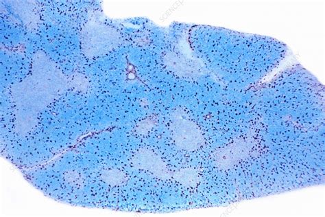 Thymus Macrophages Light Micrograph Stock Image C062 0328 Science Photo Library