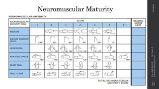 Ballard Scale Maturational Assessment Of Gestational Age Pptx