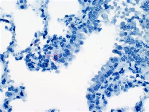 Scientists Identify Interferon Gamma As Potential Sars Cov 2 Antiviral