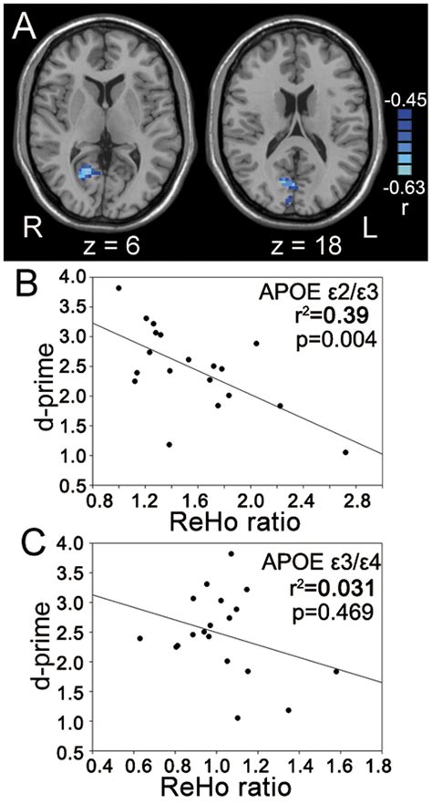 Correlation Map Between Reho Ratio And D Prime In The Visual Cortex