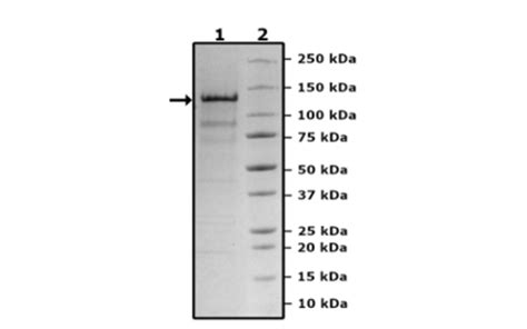 Parg His Tag Recombinant
