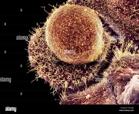 Chlamydia Infection Coloured Scanning Electron Micrograph Of A