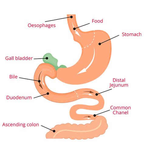 Gastric Bypass Surgery Gastric Turkey