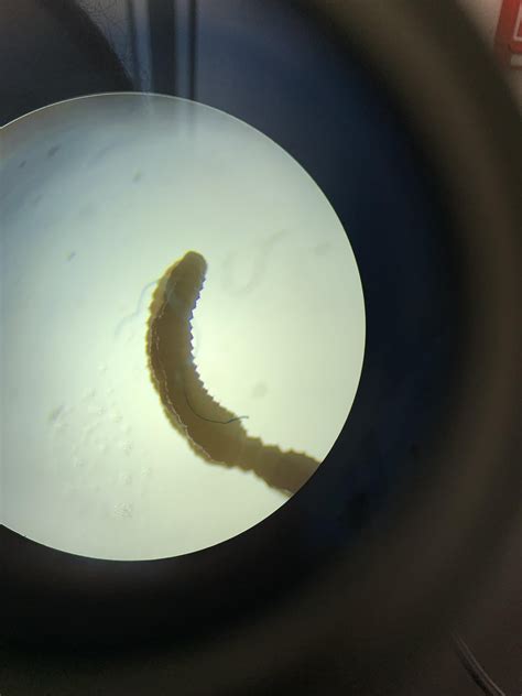 What Is This Worm Hookworm Pg 215 Rparasites