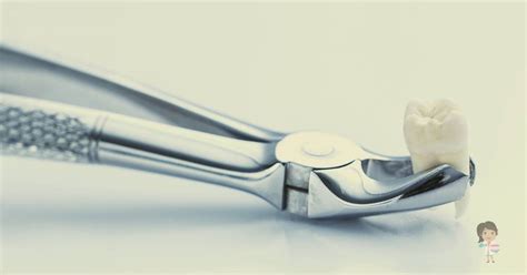 How To Prevent Dry Socket After Wisdom Teeth Removal Year