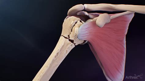 Gaurang Prajapati Posted On Linkedin