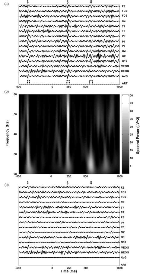 Figure 4 From Eeg Phase Synchrony Differences Across Visual Perception Conditions May Depend On