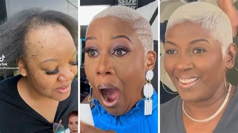 Hairstyles For Women With Alopecia