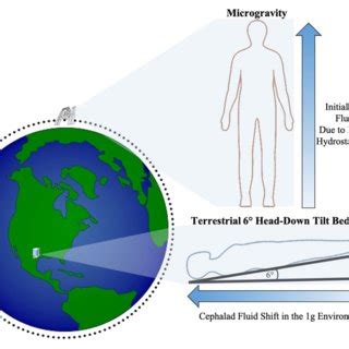 Illustration Of The Initial Cephalad Fluid Shift In The Microgravity