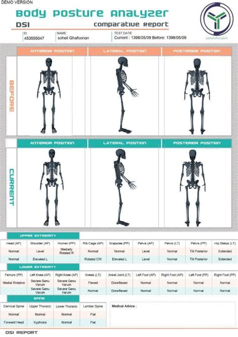 Body Posture Analyzer دسی‌کالا